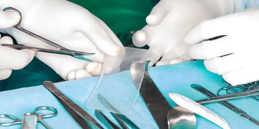 What Is Mesh Fabric Material? A Simple Guide
